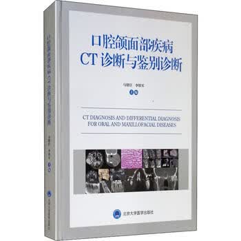 口腔颌面部疾病CT诊断与鉴别诊断