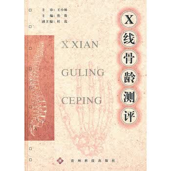 X线骨龄测评 焦俊　主编
