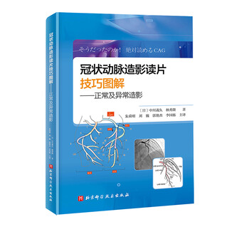冠状动脉造影读片技巧图解正常及异常造影 中川义久 林秀隆 从冠脉造影小白快速进阶PCI达人视频版北京科学技术出版9787571419929
