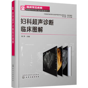 妇科超声诊断临床图解