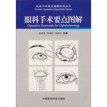 眼科手术要点图解