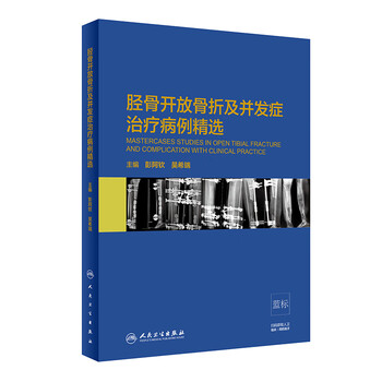 胫骨开放骨折及并发症治疗病例精选(精)