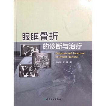 眼眶骨折的诊断与治疗