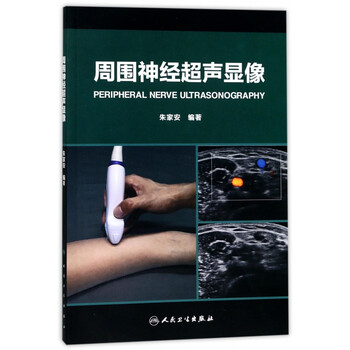 周围神经超声显像