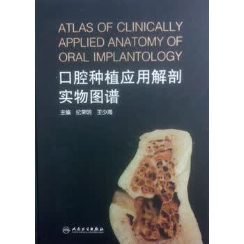 口腔种植应用解剖实物图谱