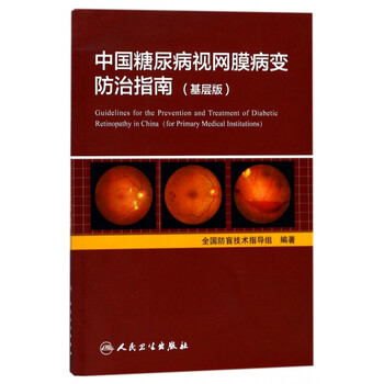 中国糖尿病视网膜病变防治指南(基层版)