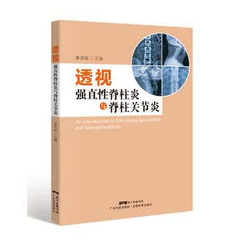 透视强直性脊柱炎与脊柱关节炎