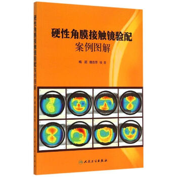 硬性角膜接触镜验配案例图解