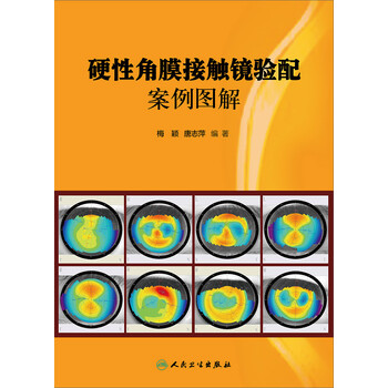 硬性角膜接触镜验配案例图解9787117208857