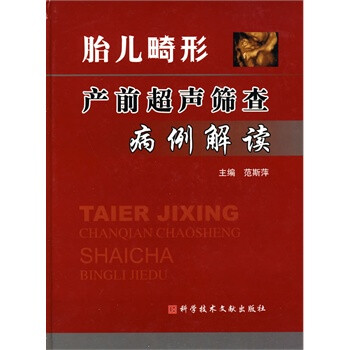 胎儿畸形产前超声筛查病例解读