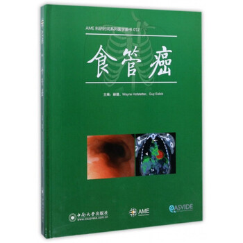 食管癌 医学 > 肿瘤学书籍 中南大学出版社