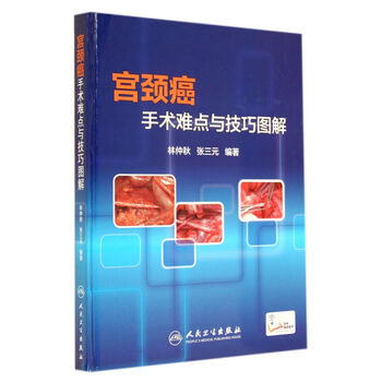 宫颈癌手术难点与技巧图解(精)