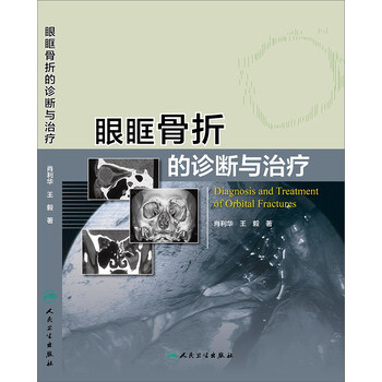 眼眶骨折的诊断与治疗