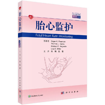 胎心监护