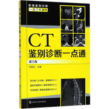 CT鉴别诊断一点通(第3版)