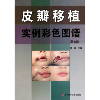 皮瓣移植实例彩色图谱(第2版)(精)