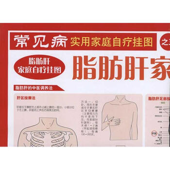 脂肪肝家庭自疗挂图/常见病实用家庭自疗挂图