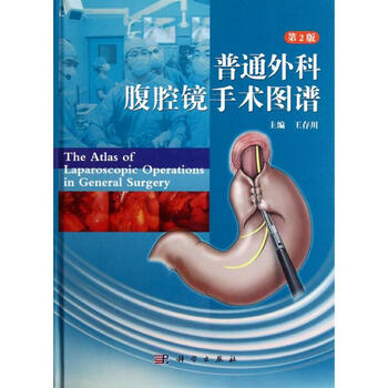 普通外科腹腔镜手术图谱(第2版)
