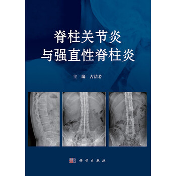 [按需印刷] 脊柱关节炎与强直性脊柱炎