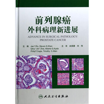 前列腺癌外科病理新进展(精)