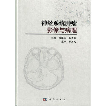 神经系统肿瘤影像与病理
