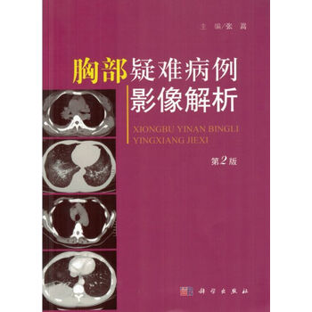胸部疑难病例影像解析（第二版）张嵩/科学出版社