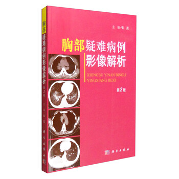 胸部疑难病例影像解析（第二版）