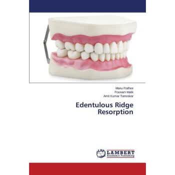 Edentulous Ridge Resorption