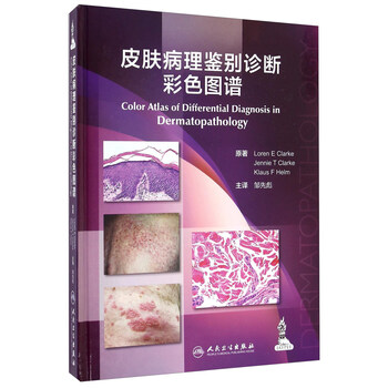 皮肤病理鉴别诊断彩色图谱（翻译版）