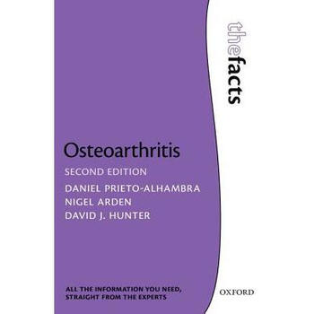 Osteoarthritis: The Facts: The Facts