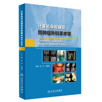 计算机导航辅助骨肿瘤外科手术学