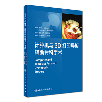 计算机与3D打印导板辅助骨科手术
