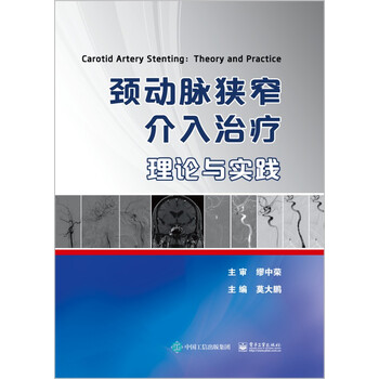 颈动脉狭窄介入治疗：理论与实践
